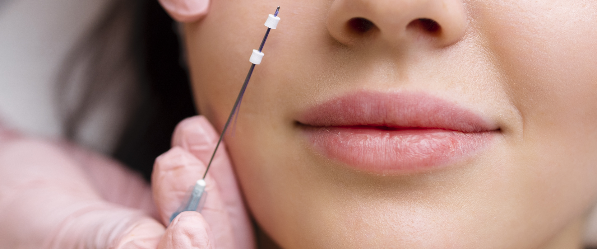 Facelift/Thread lift in Biratnagar, Nepal | Youthful Skin at Bloom Dental and Aesthetics